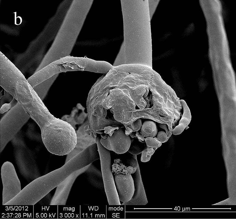 What Are The Symptoms Of Mucormycosis, How Is Mucormycosis Treated ...