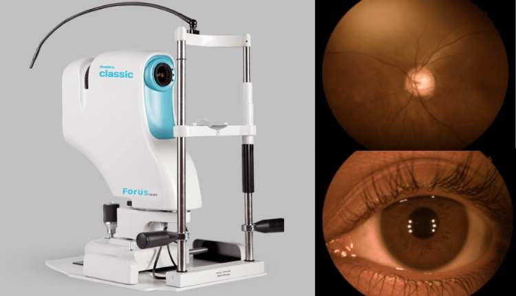 Eye Health - Eye Health Nepal