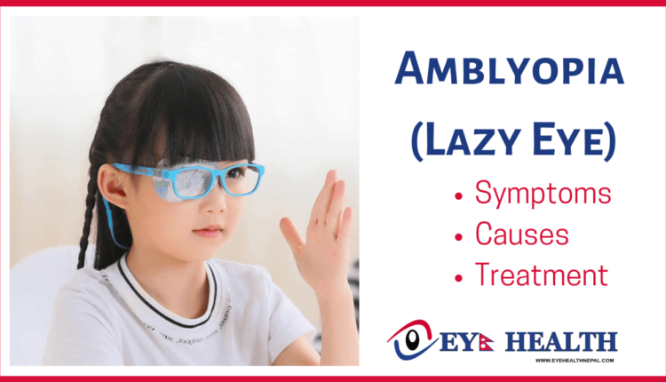 Amblyopia, Sign and Symptoms, Causes, and Treatment - Eye Health Nepal