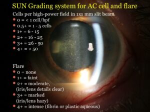 Grading In Ophthalmology - Eye Health Nepal