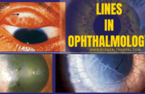 What Is Pinhole Visual Acuity? Pinhole Eyeglasses Facts - Eye Health Nepal