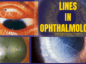 Rings in Ophthalmology - Eye Health Nepal