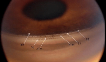 Lines in Ophthalmology - Eye Health Nepal