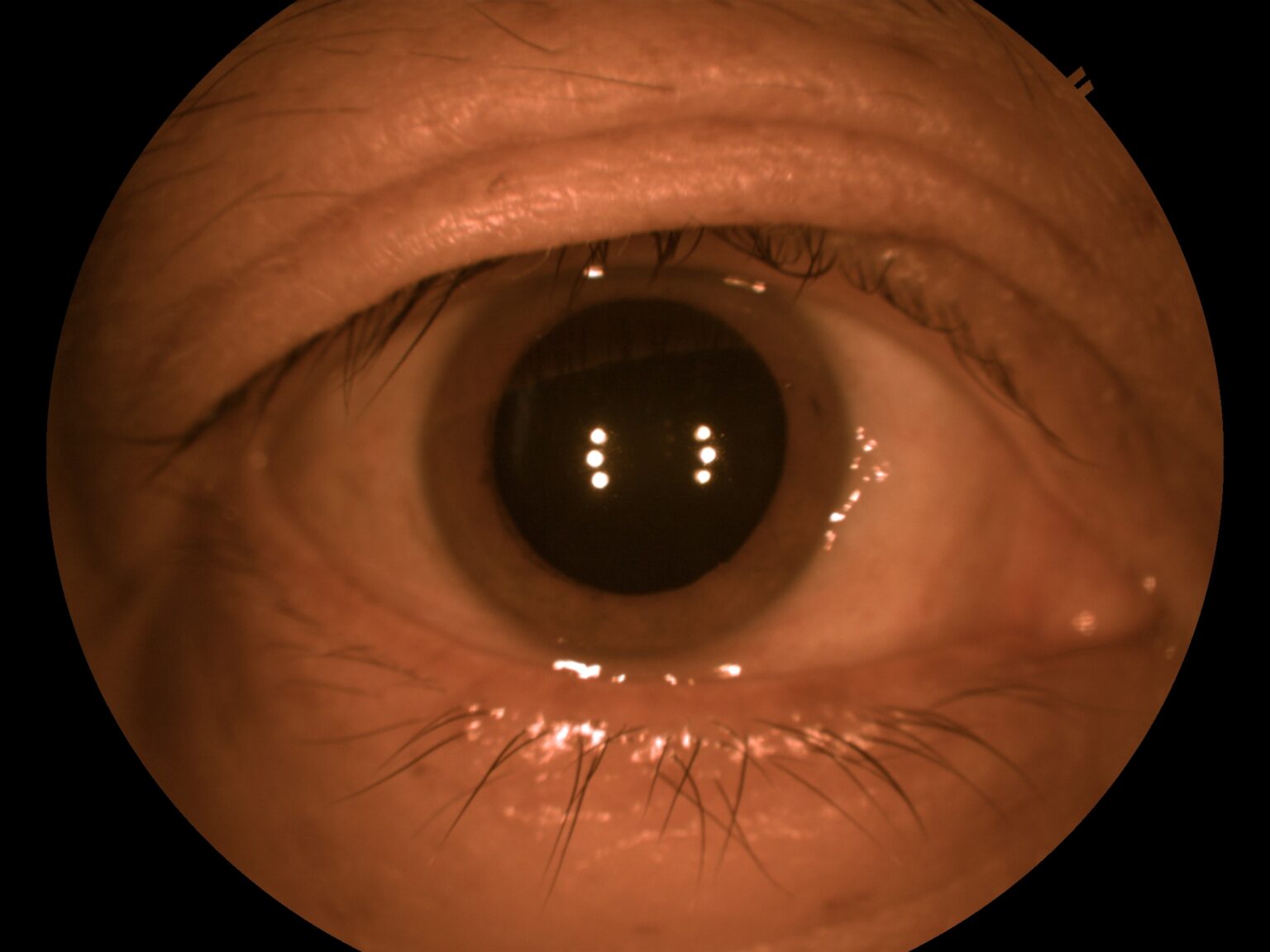 Review of 3nethra Classic Digital Non-mydriatic Fundus Camera - Eye ...