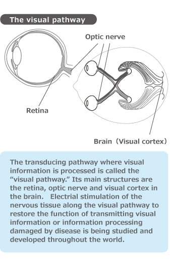 Visual Prostheses : Binoic Eyes and Its Types - Eye Health Nepal