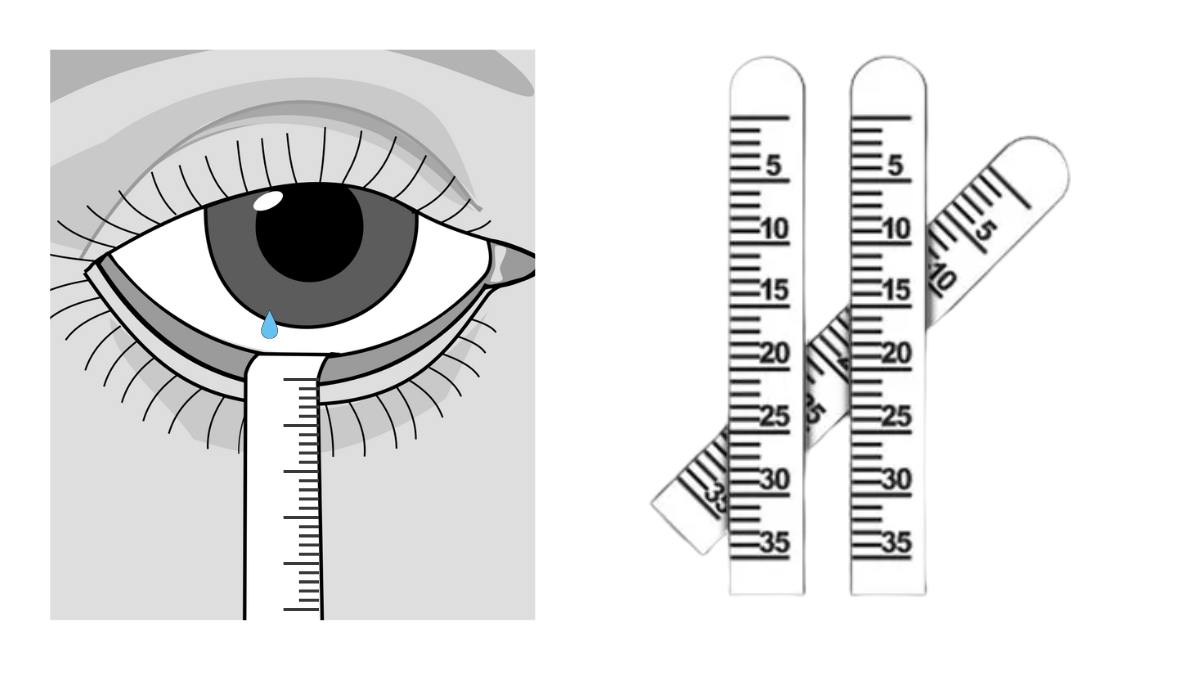 Tests for Diagnosing Dry Eye Syndrome - Eye Health Nepal